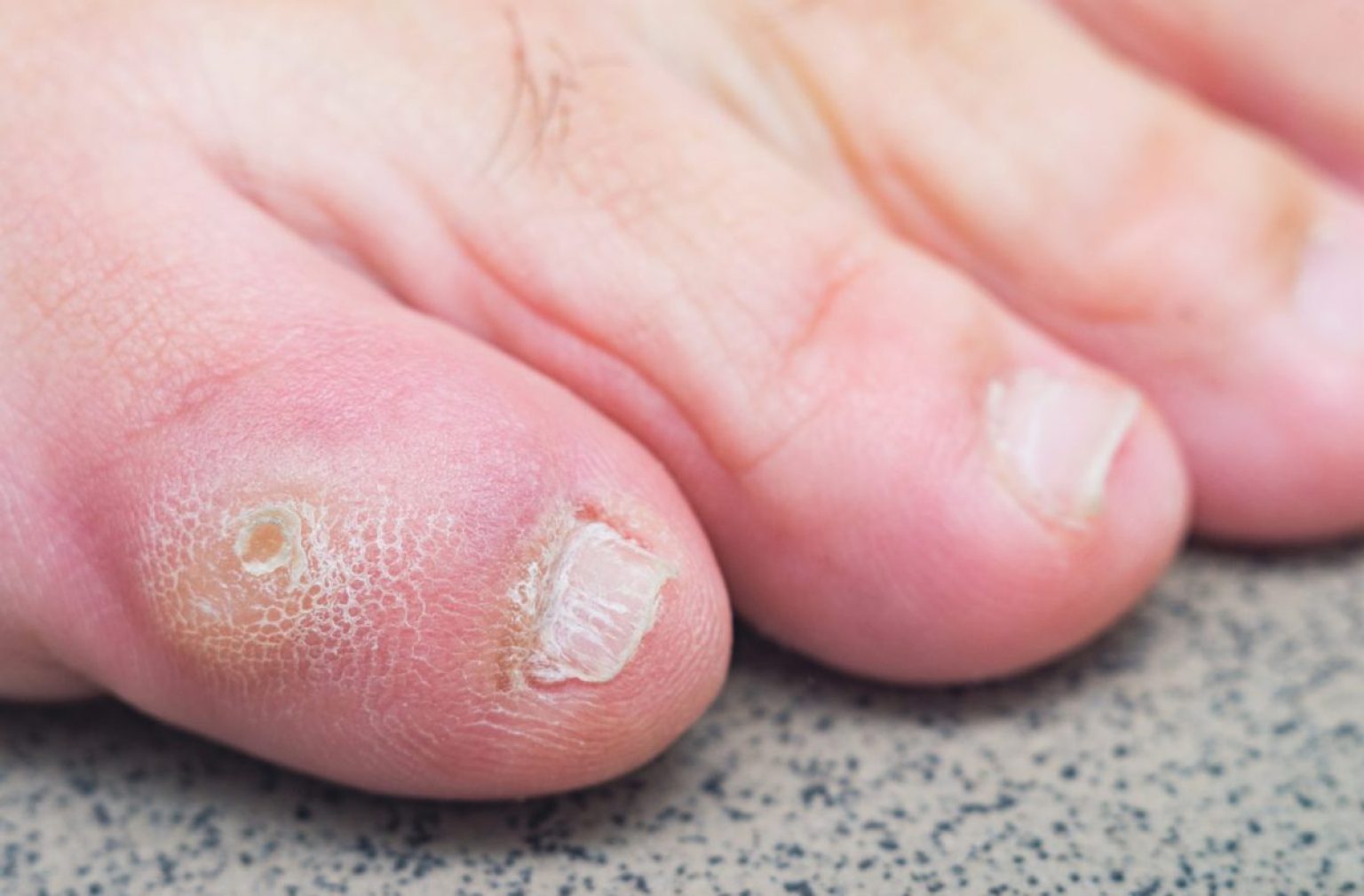 Foot Length To Shoe Size Chart: 5 Factors That Influence How a Shoe ...